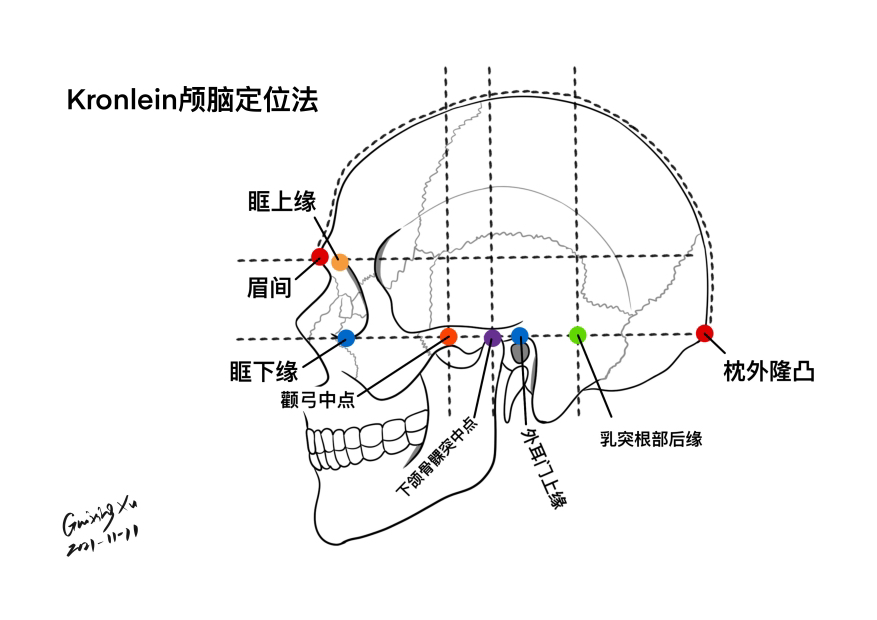Kronlein定位法 - 脑医汇