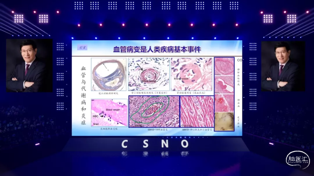 2021·CSNO学术年会 ｜众星汇聚申城 开启一场学术的饕餮盛宴！10月21-23日 - 脑医汇 - 神外资讯 - 神介资讯