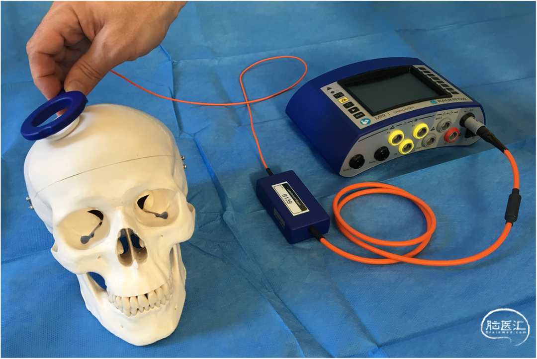 特发性颅内高压的诊断和治疗优化的长期遥测颅内压监测 - 脑医汇 - 神外资讯 - 神介资讯