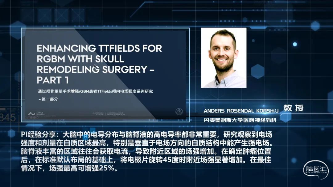 秒懂TTFields-2021年度热门盘点 - 脑医汇 - 神外资讯 - 神介资讯