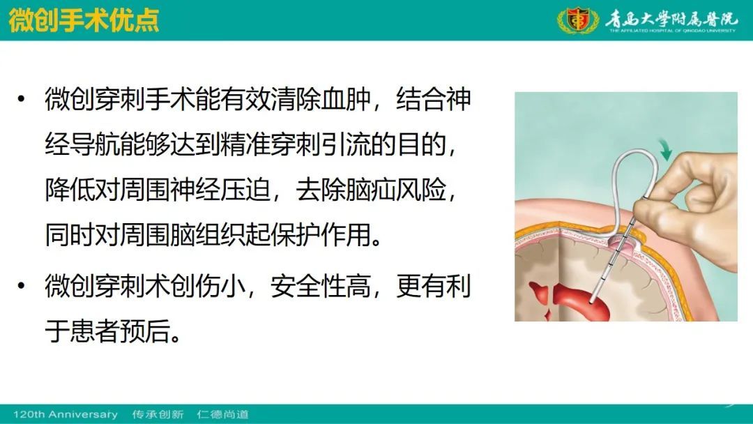 监测有道丨颅内压监测在脑出血外引流手术中的应用——颅脑创伤 神经重症周刊(第255期) 脑医汇 神外资讯 神介资讯