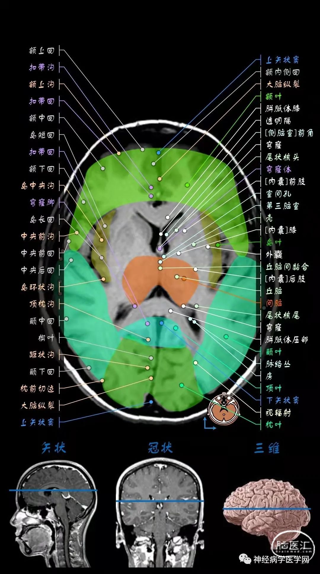 神经影像解剖系列|颅脑mri超详细三维标注(最新版) 脑医汇