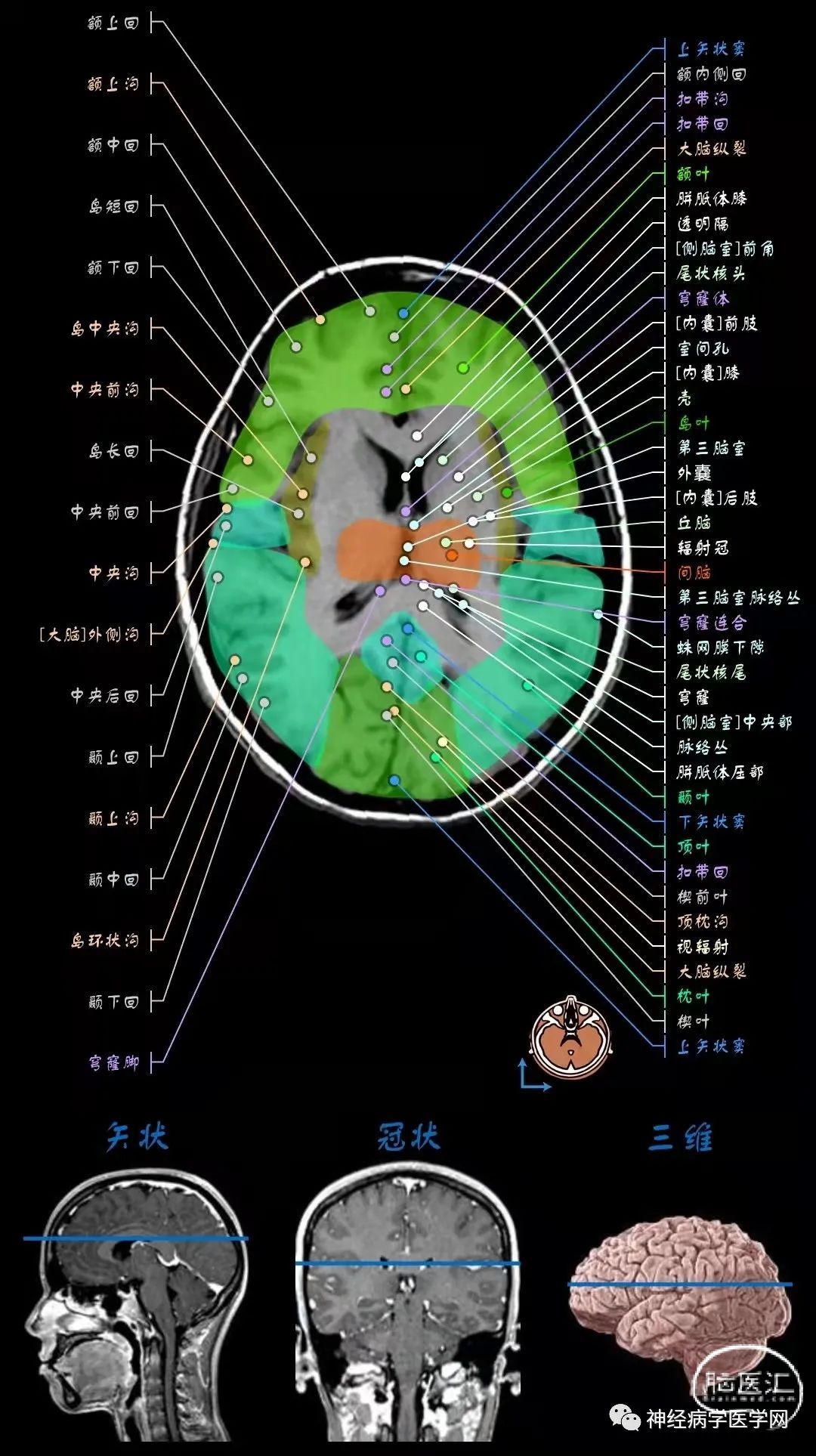 神经影像解剖系列|颅脑mri超详细三维标注(最新版) 脑医汇