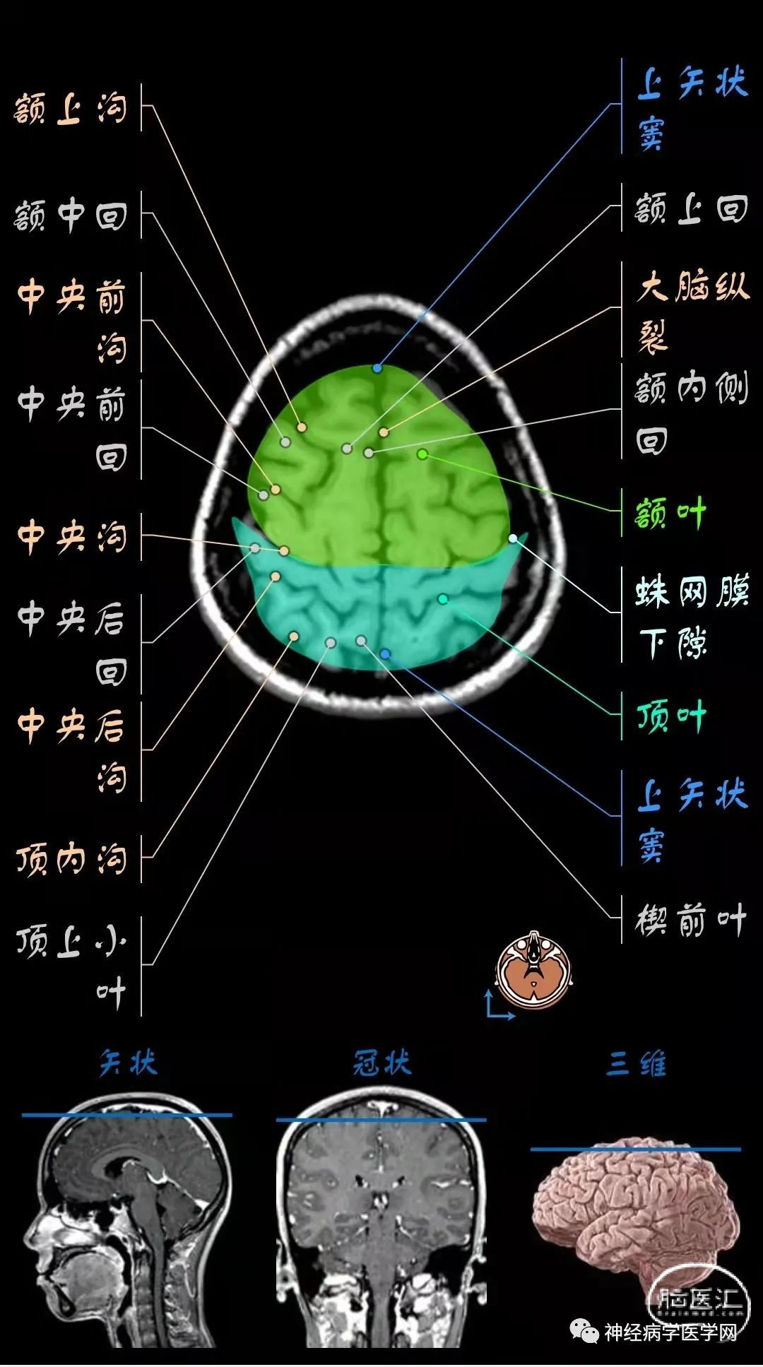 神经影像解剖系列|颅脑mri超详细三维标注(最新版) 脑医汇
