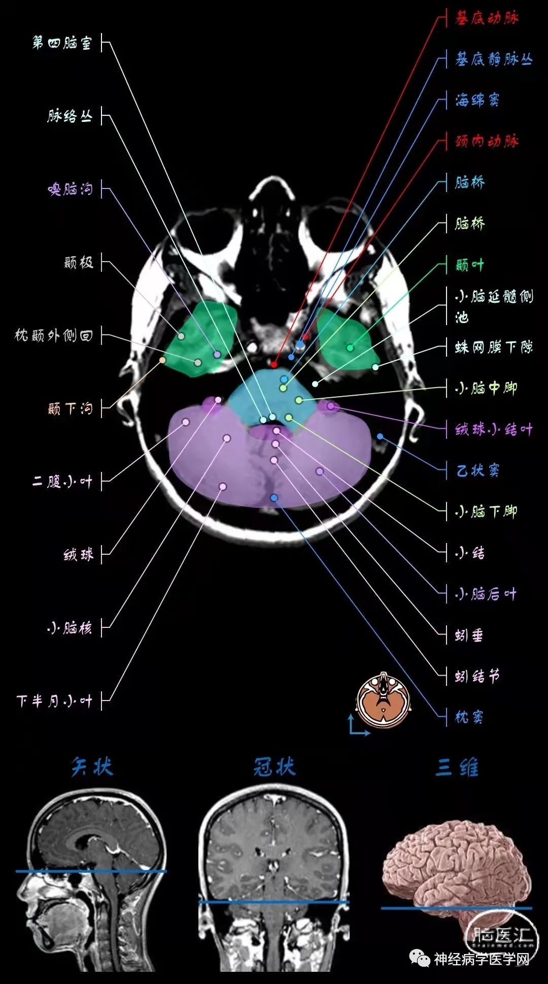 神经影像解剖系列|颅脑mri超详细三维标注(最新版) 脑医汇