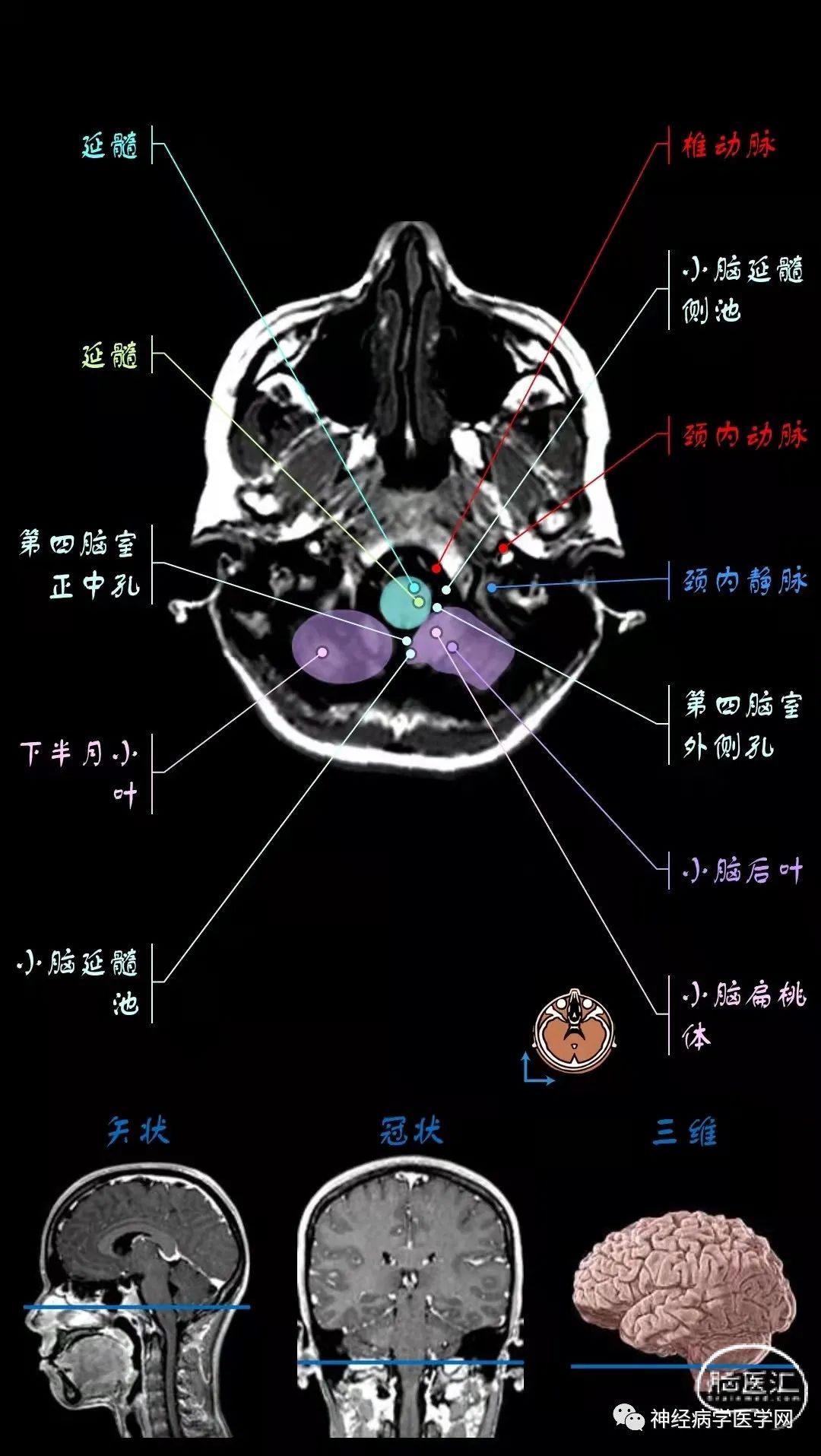 神经影像解剖系列|颅脑mri超详细三维标注(最新版) 脑医汇