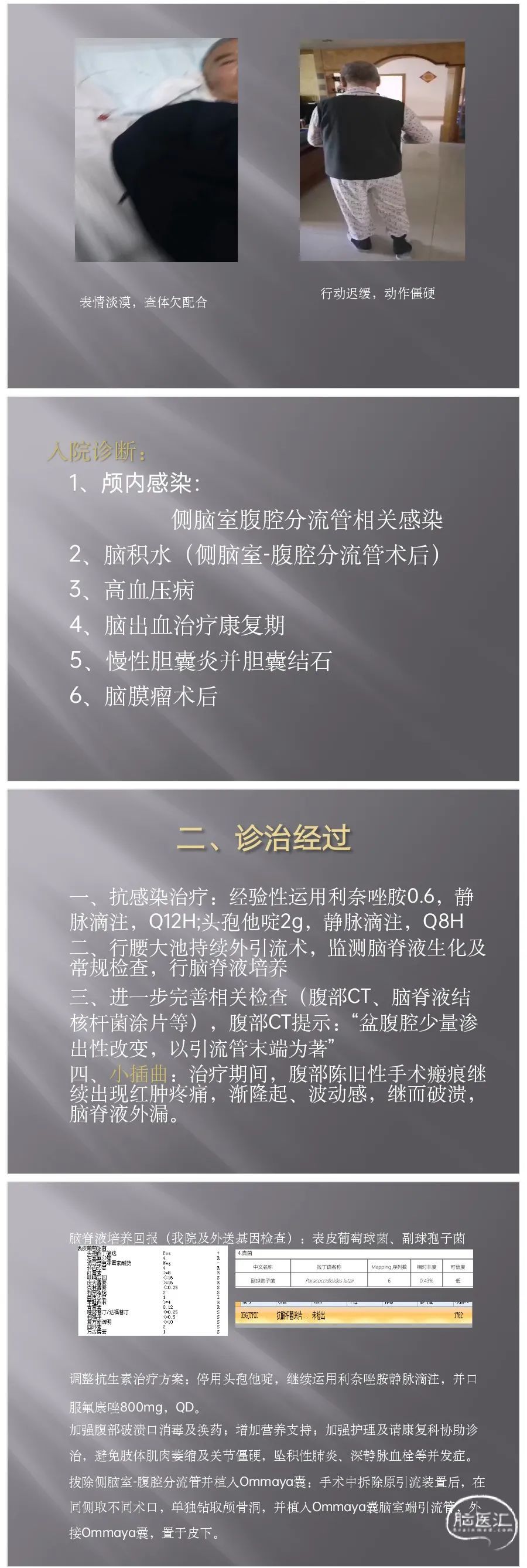监测有道丨一例脑室腹腔分流术后感染的诊治过程及心得体会——颅脑创伤 神经重症周刊(第282期) 脑医汇 神外资讯 神介资讯