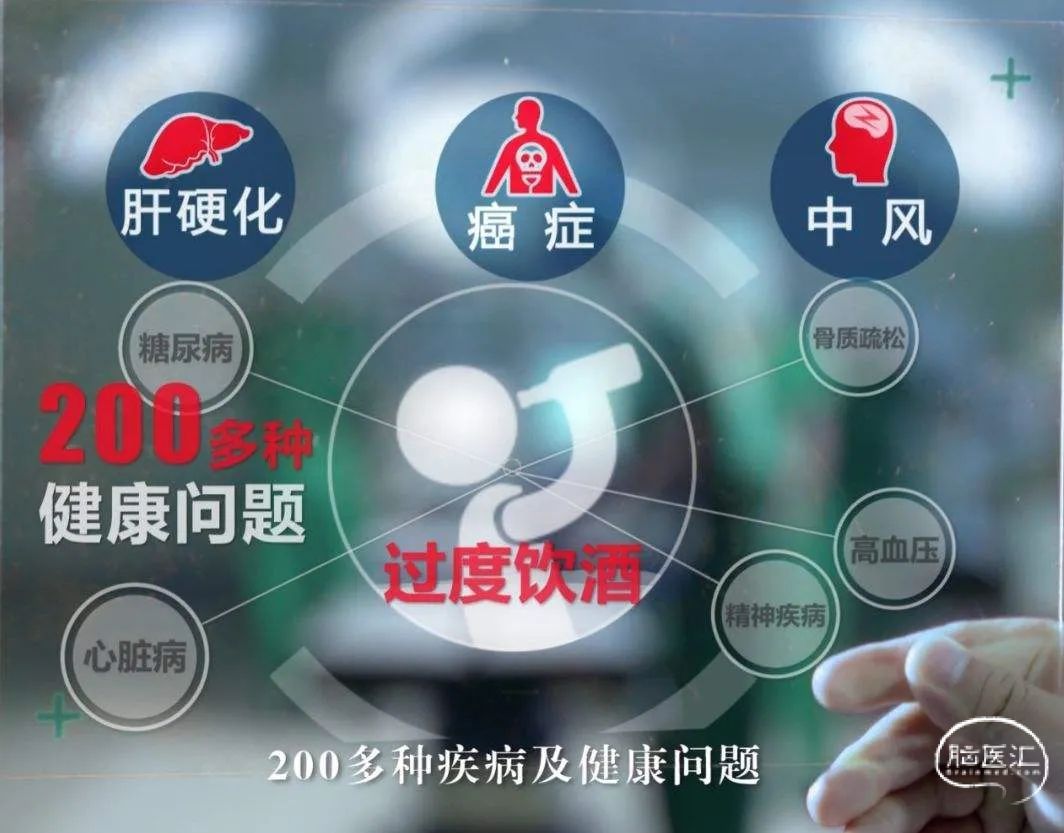 【每周科普】酒,到底是喝还是不喝? 脑医汇 神外资讯 神介资讯