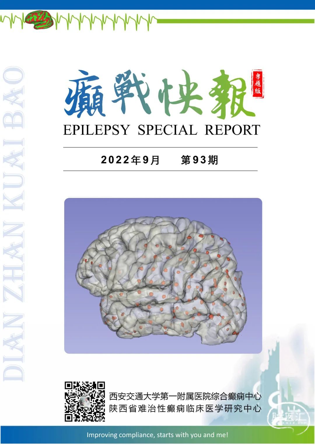 【癫战快报】第93期：专题-SEEG与硬膜下电极（SDE）在癫痫术前评估中的应用对比 - 脑医汇