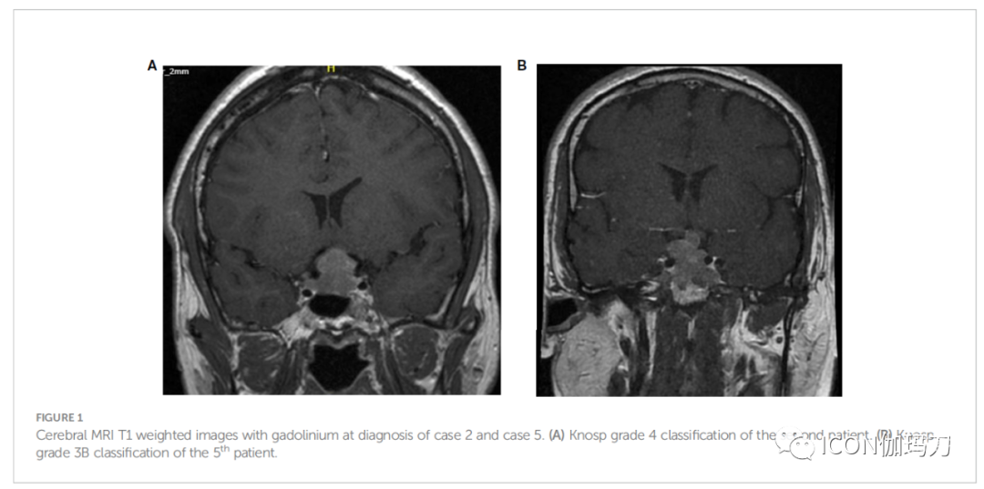 【综述】垂体癌：病例系列及文献复习 - 脑医汇