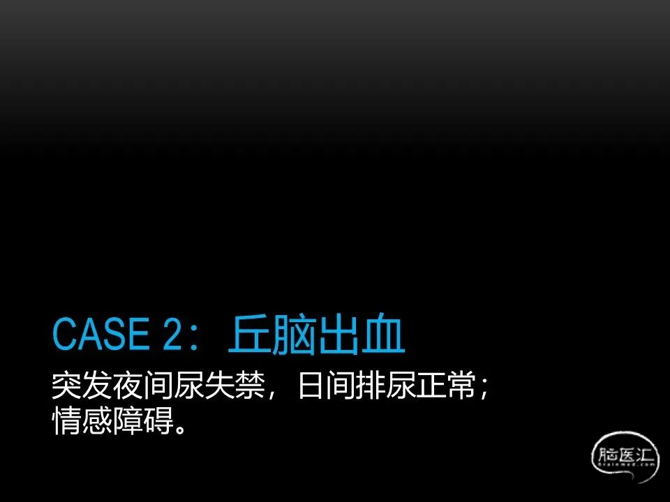 【热门】不同部位脑出血截然不同的预后 - 脑医汇