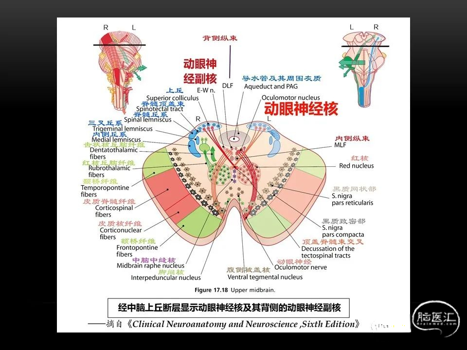 【热门】不同部位脑出血截然不同的预后 - 脑医汇