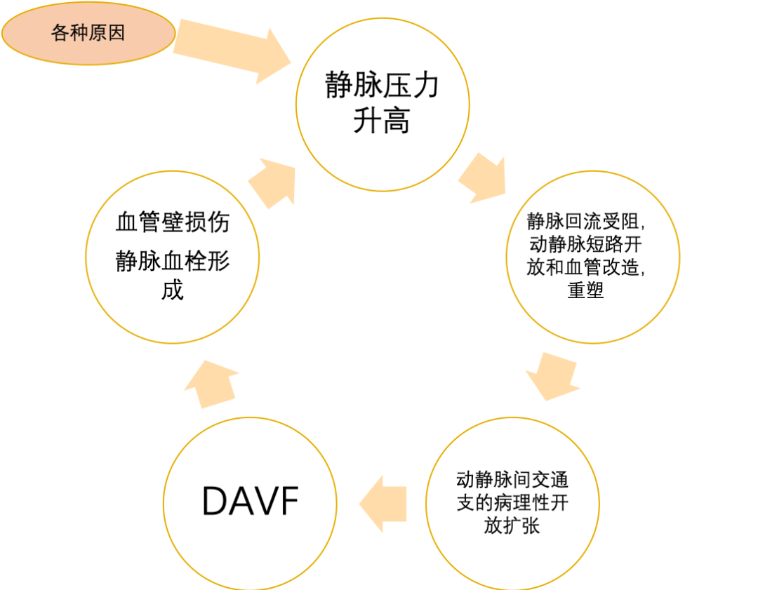 温医一院神经外科病例分享（16）：颅颈交界DAVF切除术1例 - 脑医汇