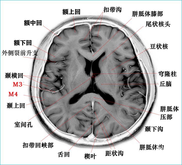 收藏必备 高清颅脑mr断层解剖图谱 脑医汇