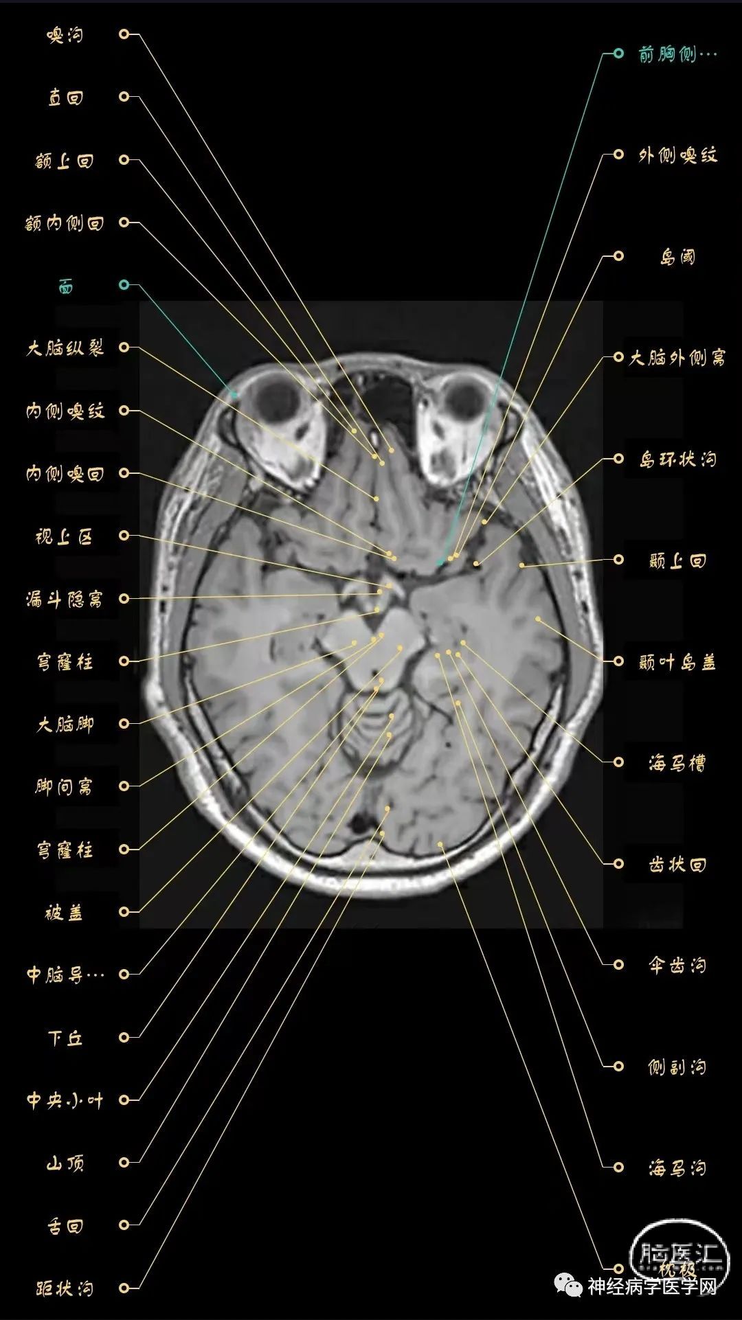 高清颅脑MRI最全轴位影像解剖 - 脑医汇