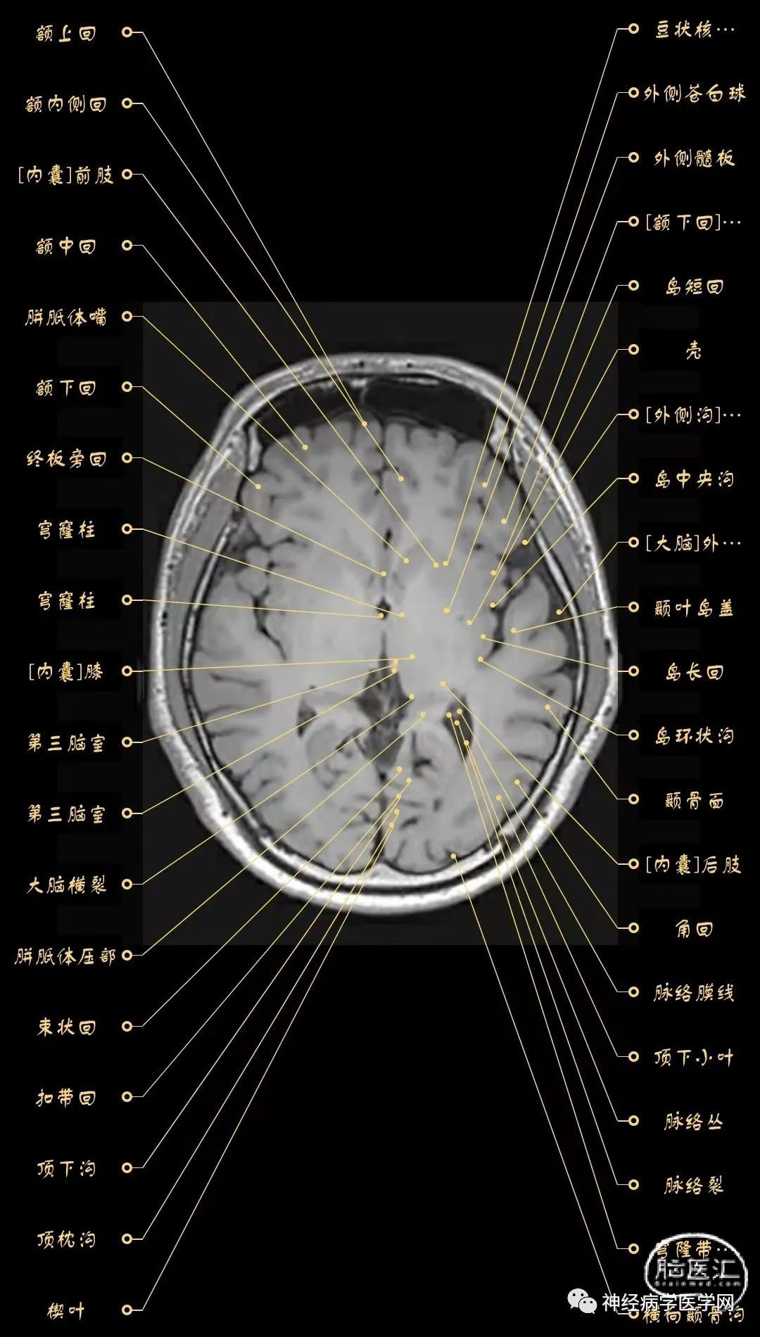 高清颅脑MRI最全轴位影像解剖 - 脑医汇