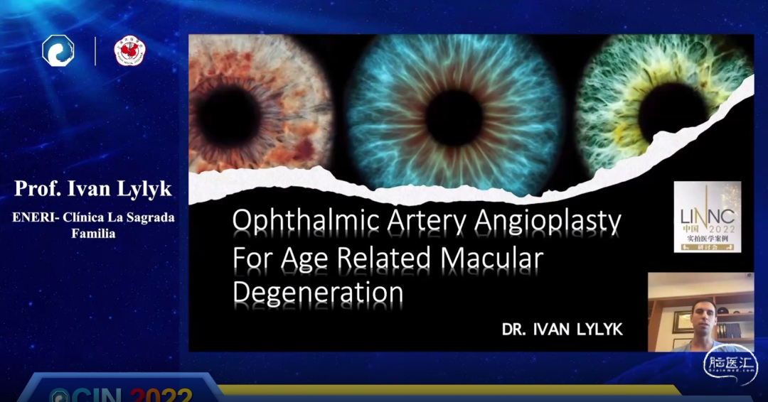 OCIN 2022丨国际论坛圆满举办：携手SIMI、SILAN，交流国际之声，共探神经介入学科发展最前沿 - 脑医汇