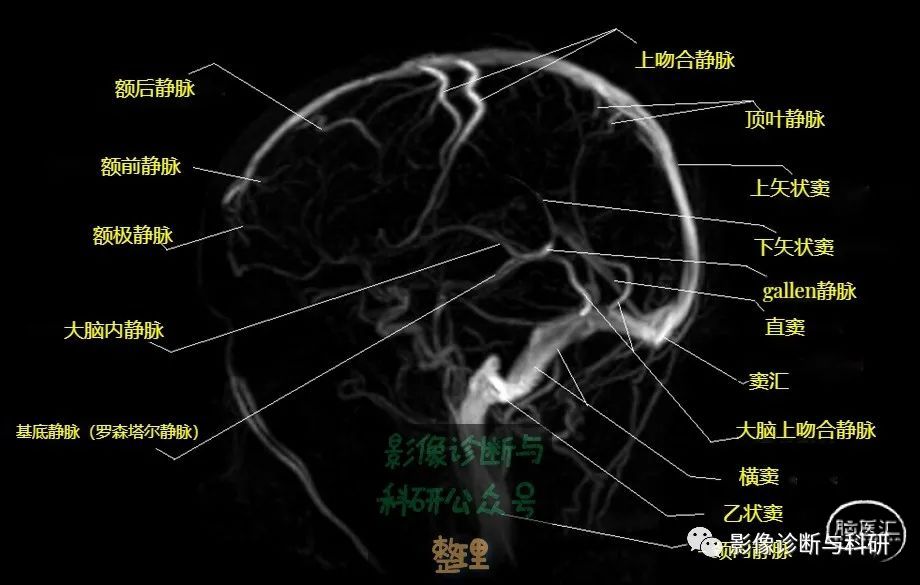 全新解剖系列之三:颅脑mramrv 脑医汇 神外资讯 神介资讯