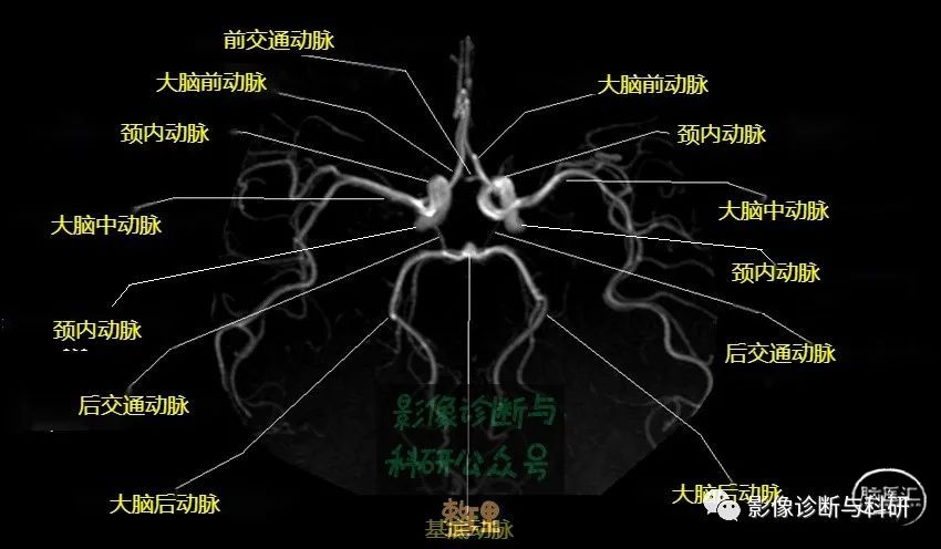全新解剖系列之三:颅脑mramrv 脑医汇 神外资讯 神介资讯