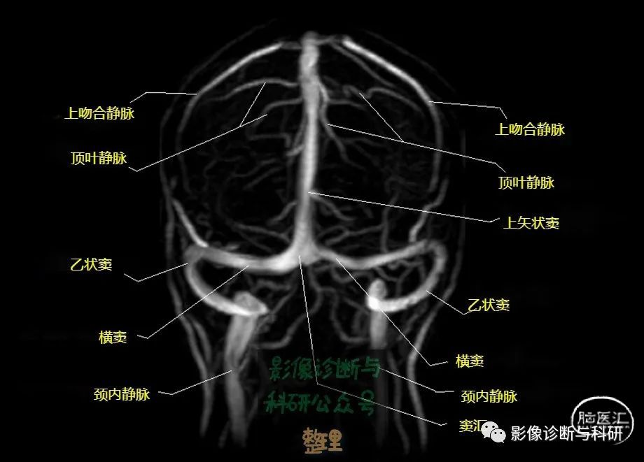 全新解剖系列之三:颅脑mramrv 脑医汇