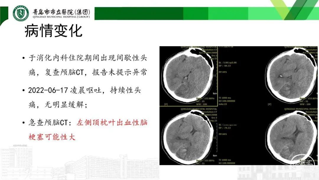 监测有道丨一例嗜酸性粒细胞肠炎并克罗恩病致颅内静脉窦血栓患者的神经重症诊疗——颅脑创伤 神经重症周刊（第303期） 脑医汇