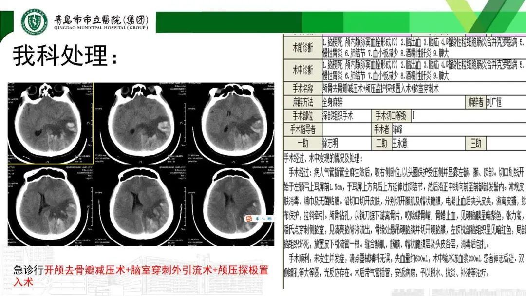 监测有道丨一例嗜酸性粒细胞肠炎并克罗恩病致颅内静脉窦血栓患者的神经重症诊疗——颅脑创伤 神经重症周刊(第303期) 脑医汇