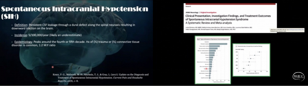 浙大二院神经外科与美国康奈尔大学神经外科线上“Grand Round”第41期 - 脑医汇