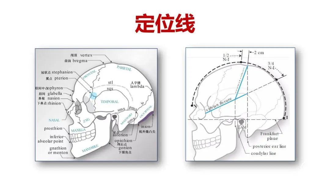 监测有道丨基底节脑出血的显微外科治疗 ——颅脑创伤 神经重症周刊(第305期) 脑医汇 神外资讯 神介资讯