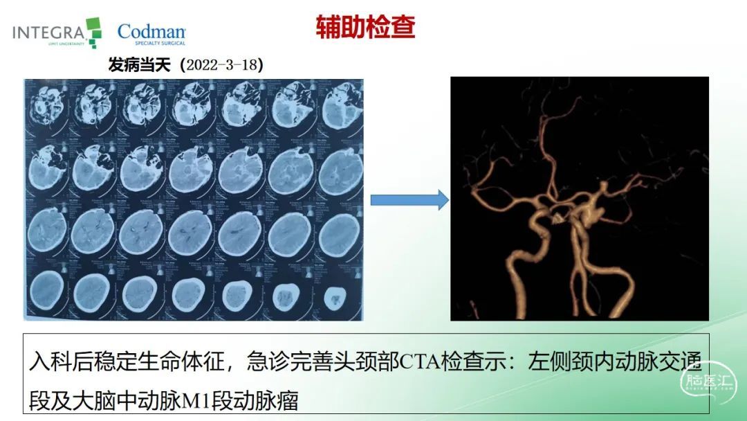【精彩回顾】2022 凝神聚例 监测有道”isti脑创伤和脑重症病例大赛优秀作品展示（四） 脑医汇