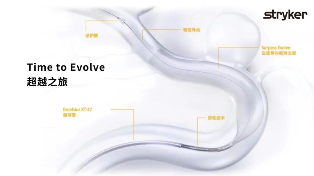 Time To Evolve 超越之旅 新一代密网支架surpass Evolve结合弹簧圈治疗眼段大动脉瘤 脑医汇