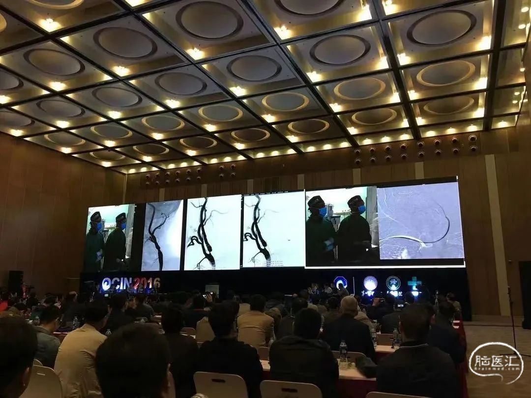 【会议预热】河南省桡动脉入路神经介入诊疗规范化培训班启动在即 脑医汇