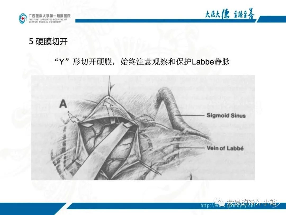 颞下入路的学习和应用 脑医汇