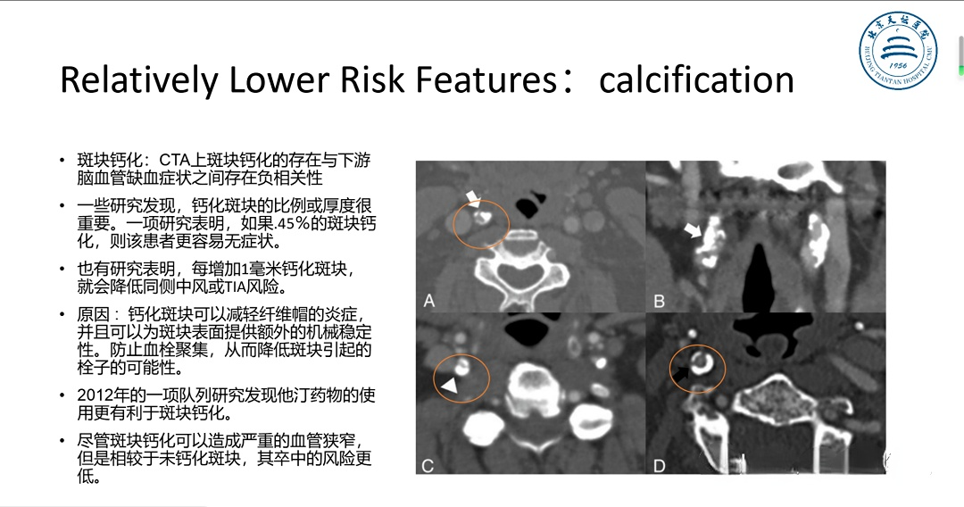 CTA的管壁成像 - 脑医汇