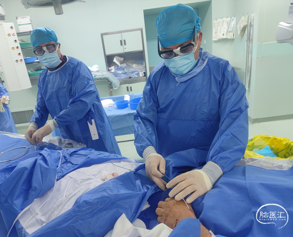 【桡道而行，有例可循】殷亮团队：Tethys®中间导引导管无支撑下经左侧远桡通路辅助行椎动脉颅内段支架植入术 - 脑医汇