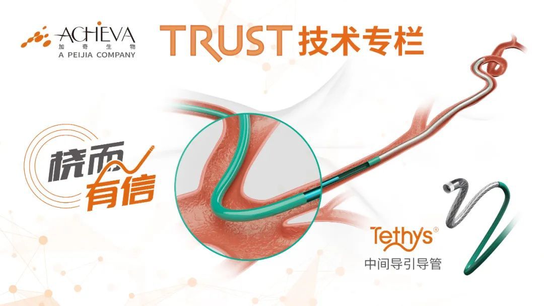 应用trust技术经右侧远端桡动脉建立入路行右侧颈内动脉床突上段支架置入术 脑医汇