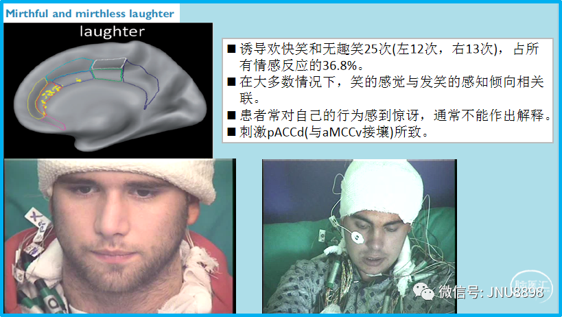 《人类扣带回电刺激研究》 - 脑医汇