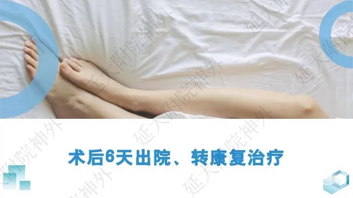 监测有道丨左侧基底节区出血破入脑室一例神经内镜下血肿清除术——颅脑创伤 神经重症周刊(第333期) 脑医汇