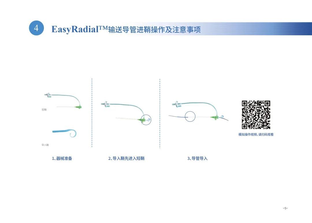 一文读懂,easyradial™输送导管如何实现guiding Solo( Egs”经桡技术续篇) 脑医汇 神外资讯 神介资讯