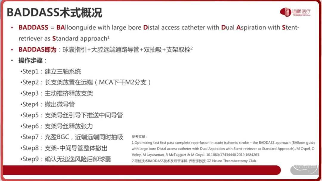 张广教授：大脑中动脉栓塞BADDASS取栓技术策略分享 - 脑医汇