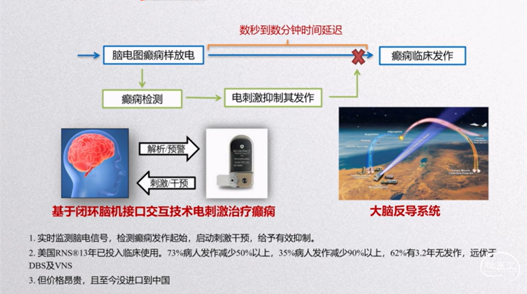 张建民教授:闭环神经调控治疗难治性癫痫临床转化研究 脑医汇