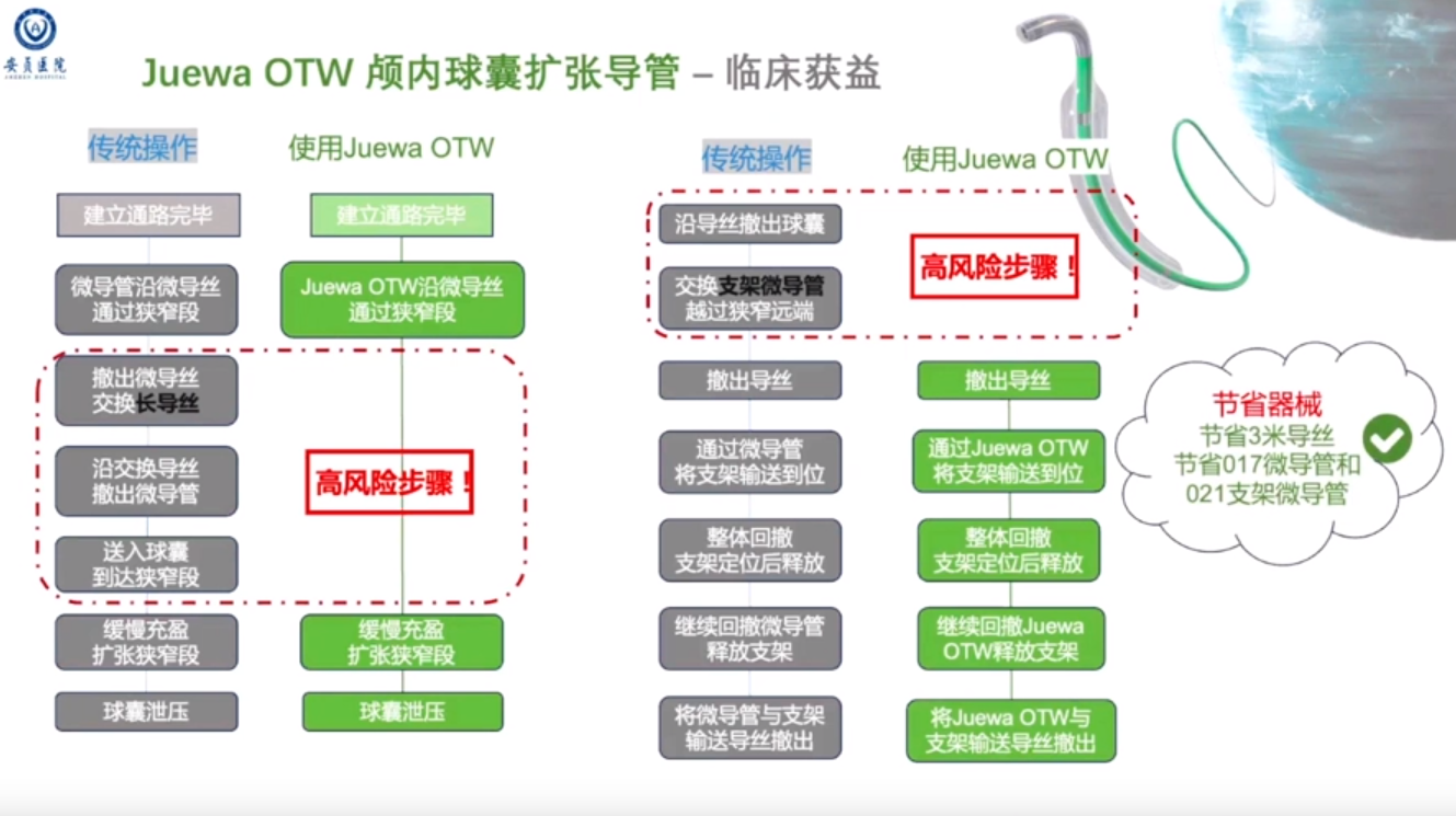 去繁就简——颅内动脉狭窄新器械带来新探索 - 脑医汇