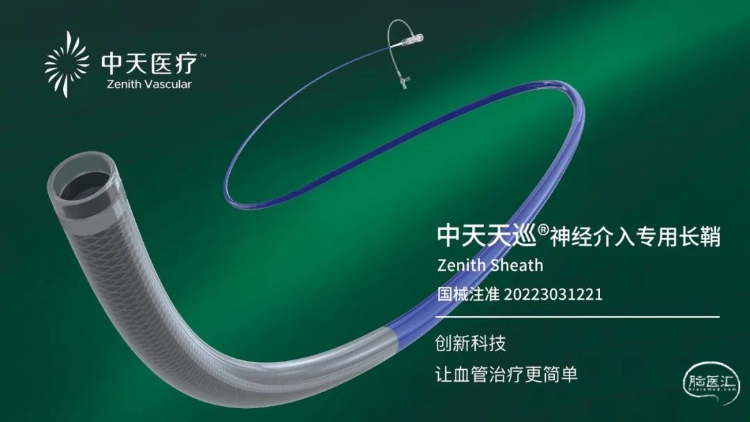 【纵横神介】onestop 病例专栏|颅内静脉窦血栓的支架及导管抽吸取栓治疗分享 脑医汇
