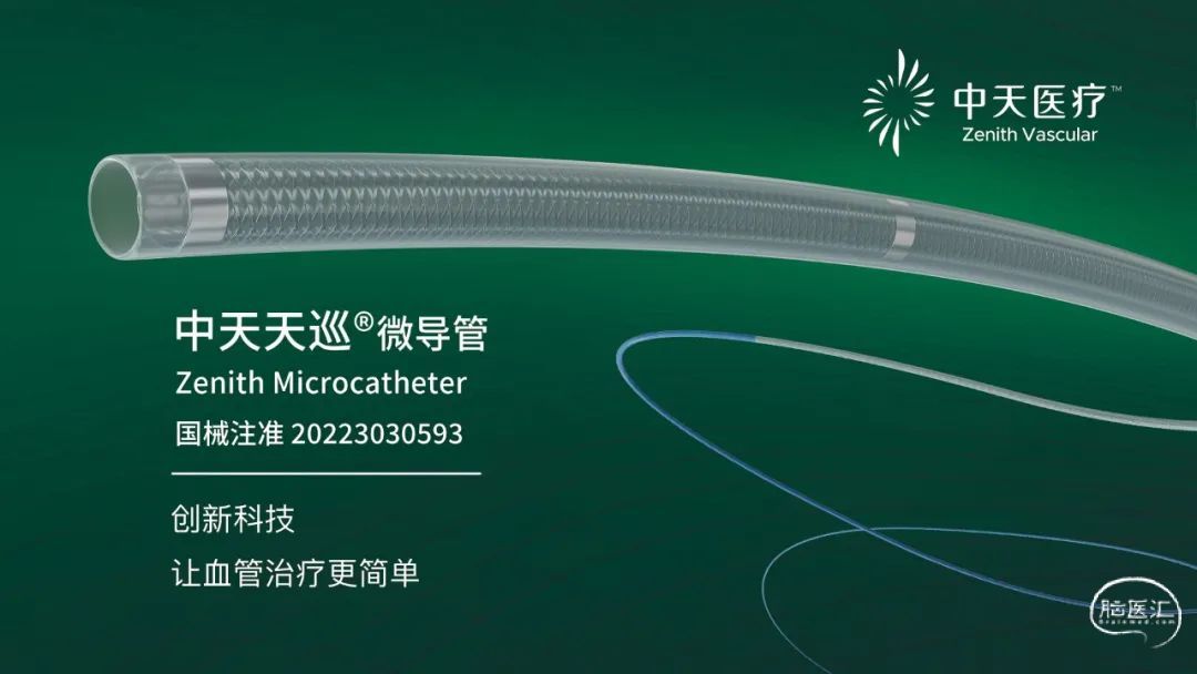 【纵横神介】onestop 病例专栏|颅内静脉窦血栓的支架及导管抽吸取栓治疗分享 脑医汇
