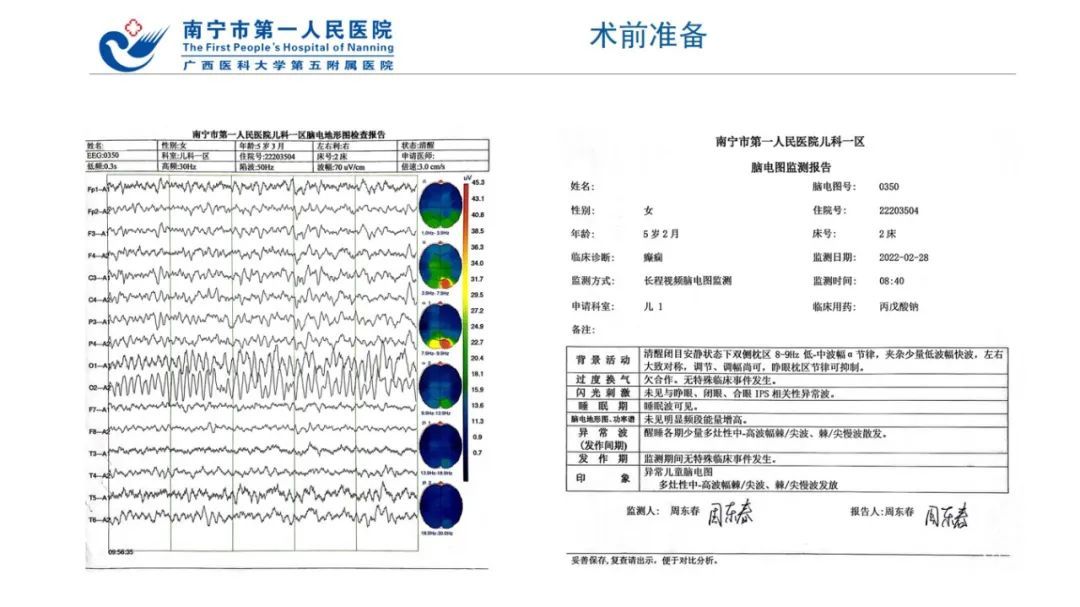 【病例分享】第六届全国胶质瘤大会——胶质瘤病例分享讨论会优秀病例展示(二) 脑医汇