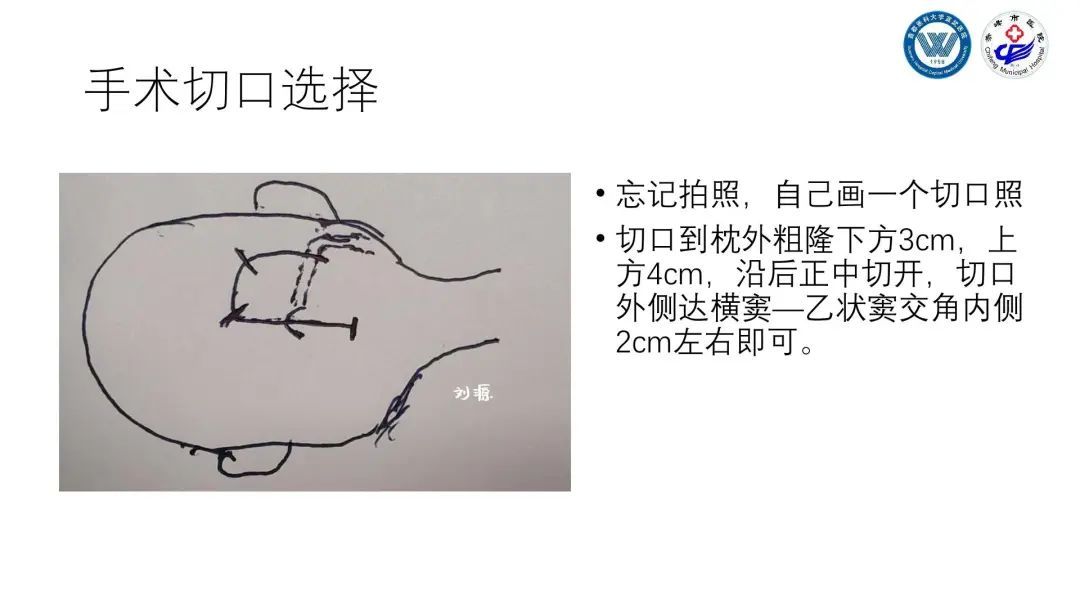 监测有道 枕骨骨折致横窦出血引起幕上下硬膜外血肿手术1例——颅脑创伤 神经重症周刊(第368期) 脑医汇 神外资讯 神介资讯