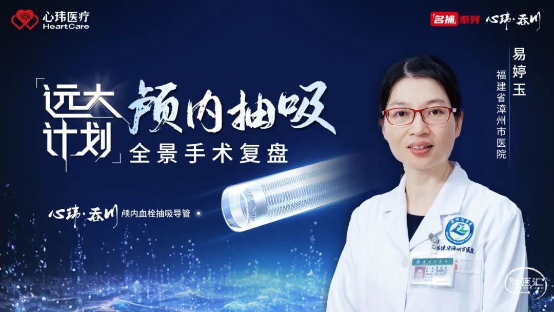 【全景手术】远大计划 易婷玉团队:心玮吞川6f颅内血栓抽吸导管应用于基底动脉闭塞取栓一例 脑医汇 神外资讯 神介资讯