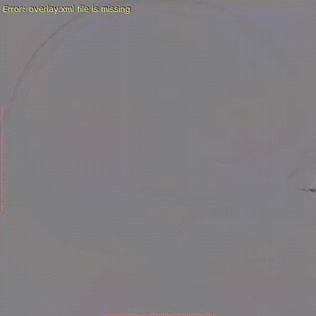 Time to Evolve 超越之旅 | Surpass Evolve支架治疗动脉瘤一例 - 脑医汇