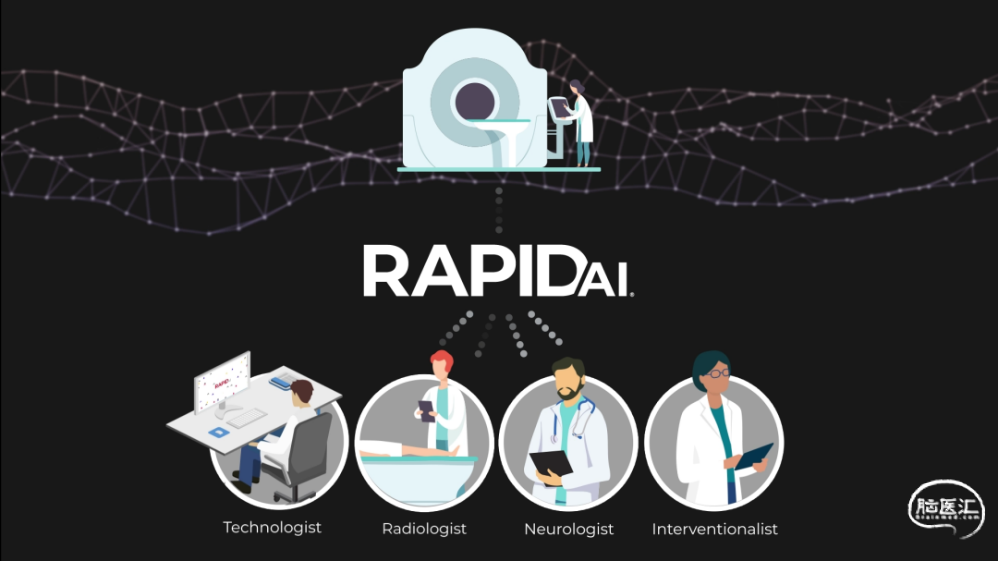 【风向标 I 技术】两项研究凸显Rapid AI平台在检测LVO和SDH方面的优越性能 - 脑医汇