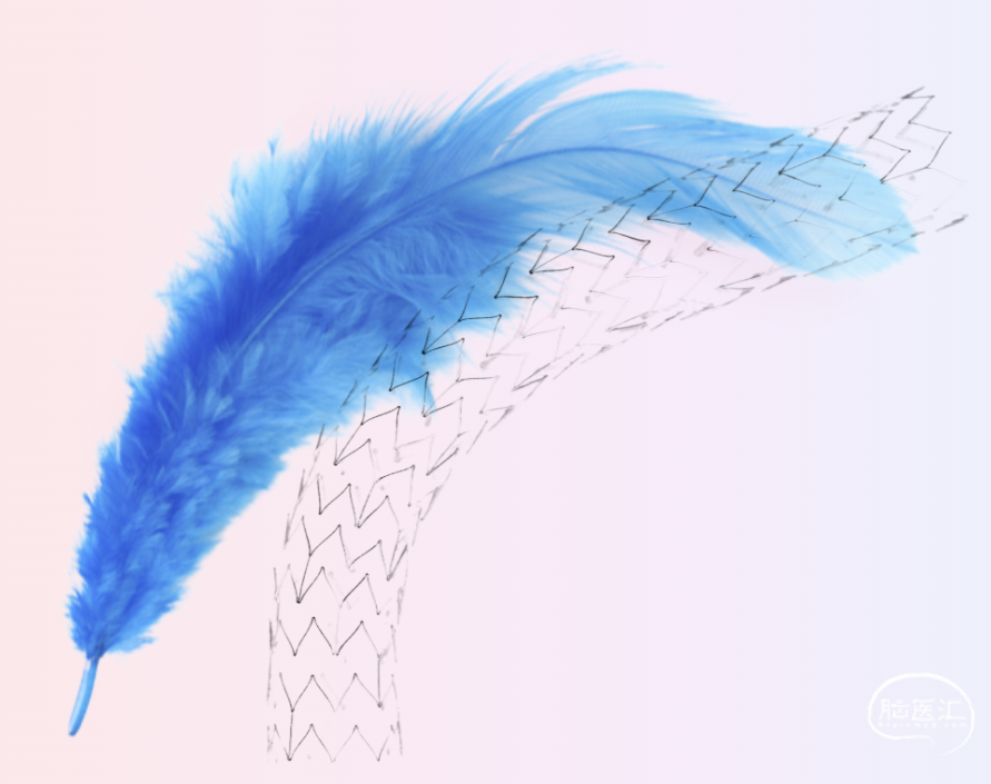 【风向标｜研究】第一款颅内静脉窦专用支架River Stent治疗特发性颅内高压的首项前瞻性多中心研究一年期结果出炉 - 脑医汇