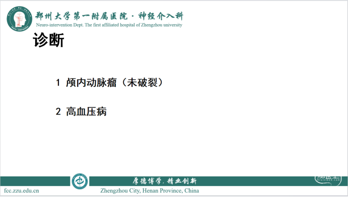 全麻下右侧颈内动脉末端动脉瘤web瘤内扰流装置植入术